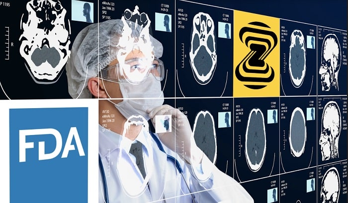Zebra Medical Vision Secures a Fourth FDA Clearance for AI for Medical ...