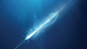 Moses 2.0: Improving the Gold Standard for Laser Lithotripsy