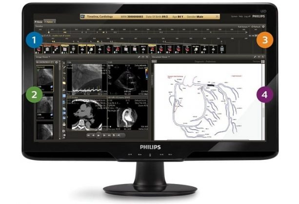 Philips introduces next generation of IntelliSpace Cardiovascular ...