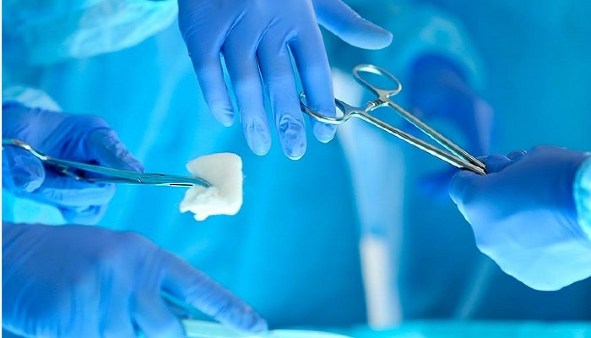 International offering for Single Use Surgical’s Pulse Lavage and ...