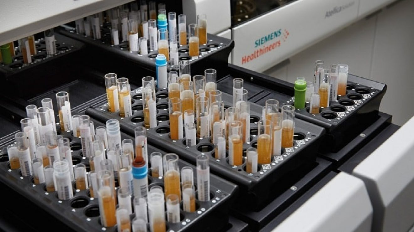 Siemens Healthineers equips new central laboratory for Munchen Klinik