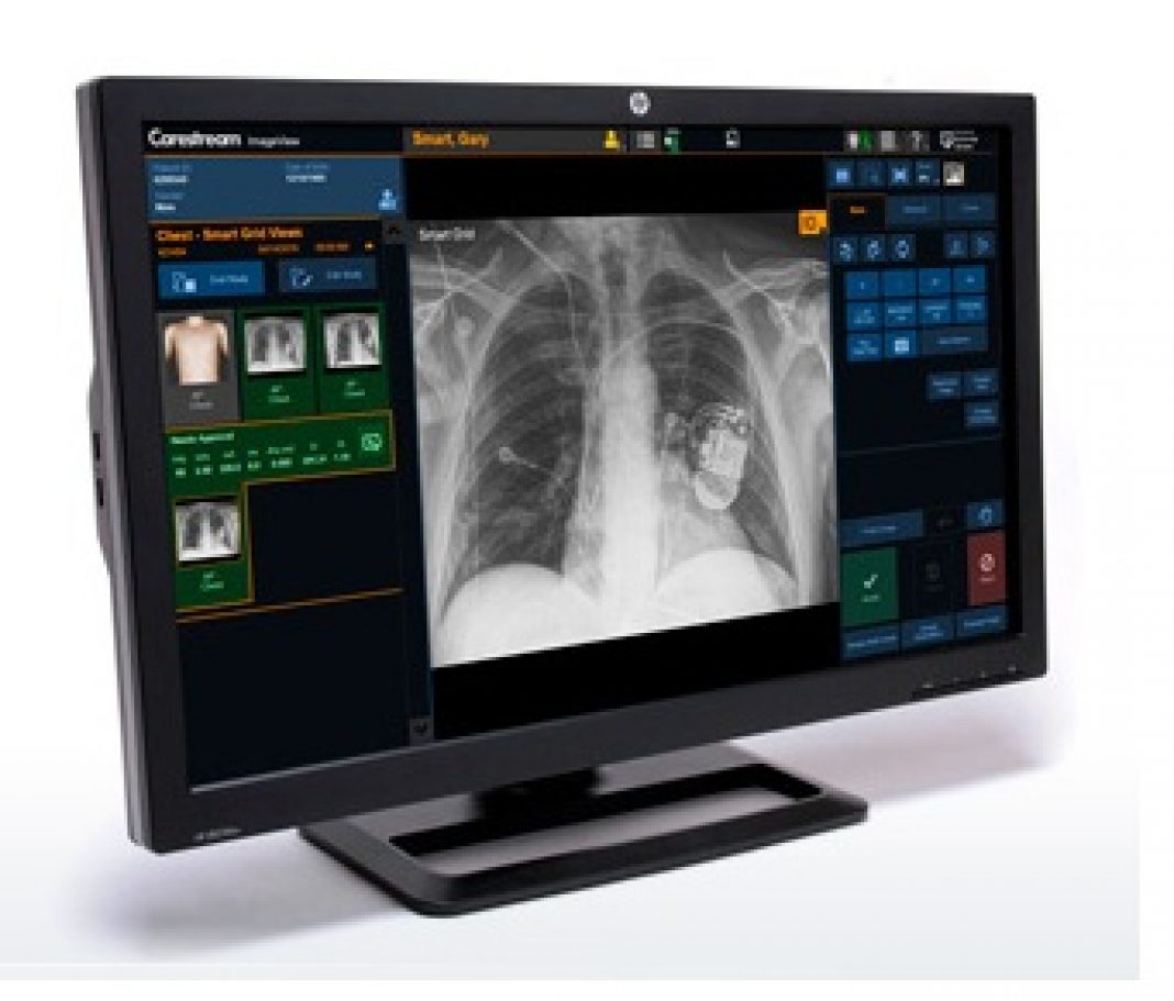 Carestream Shows Advanced Imaging Software, Flexible Portfolio of ...