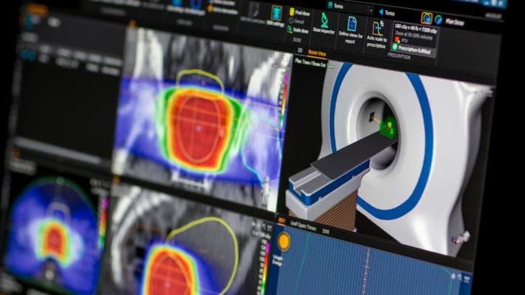 RaySearch has decided to develop RayCommand treatment control system