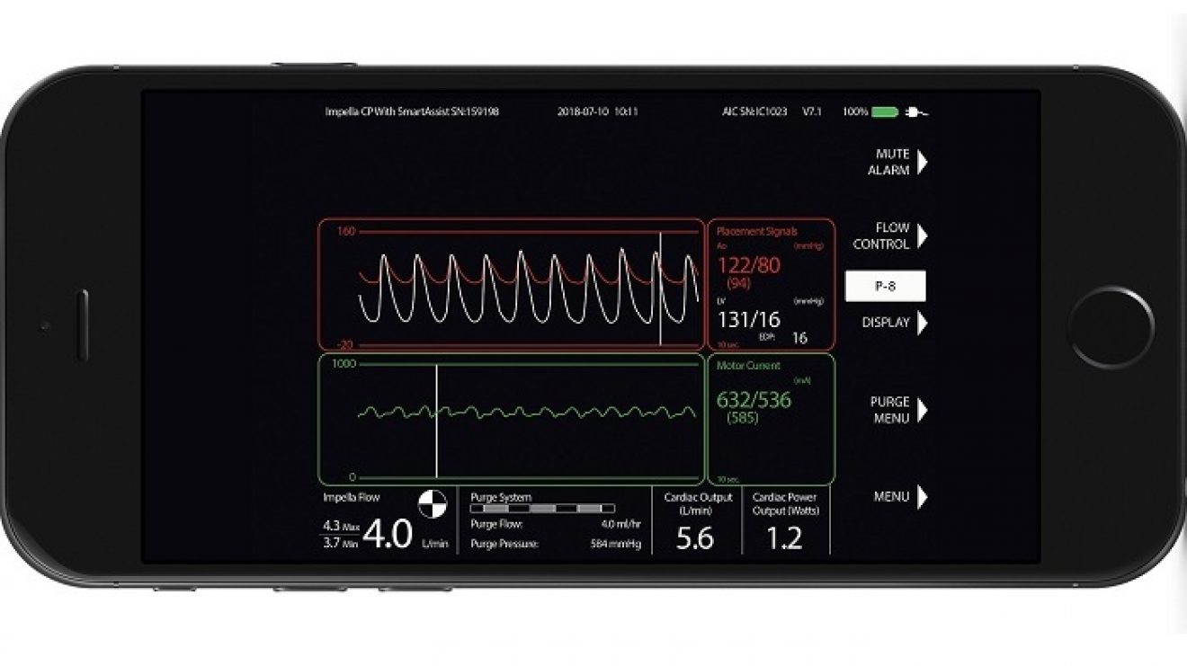 Abiomed gets CE mark for Impella Connect cloud-based monitoring platform
