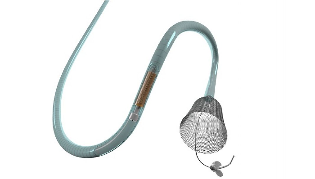 Medtronic Receives FDA Approval for Pipeline Flex Embolization Device