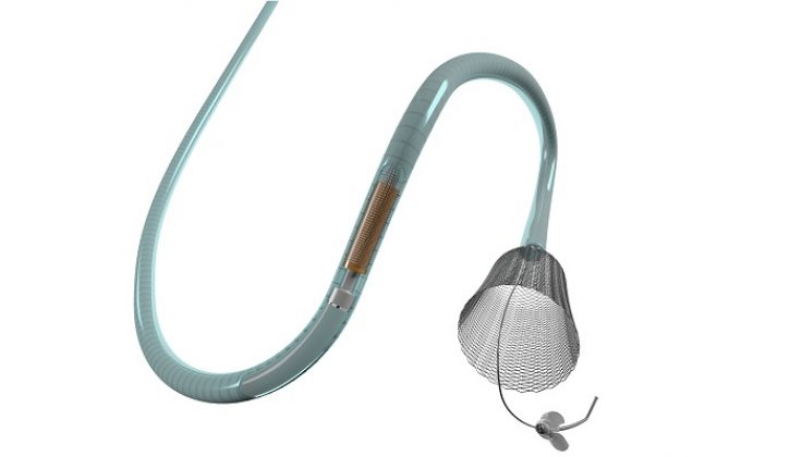 Medtronic Receives FDA Approval for Pipeline Flex Embolization Device