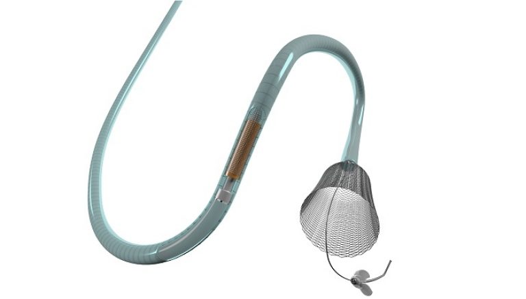 Medtronic Receives FDA Approval for Pipeline Flex Embolization Device